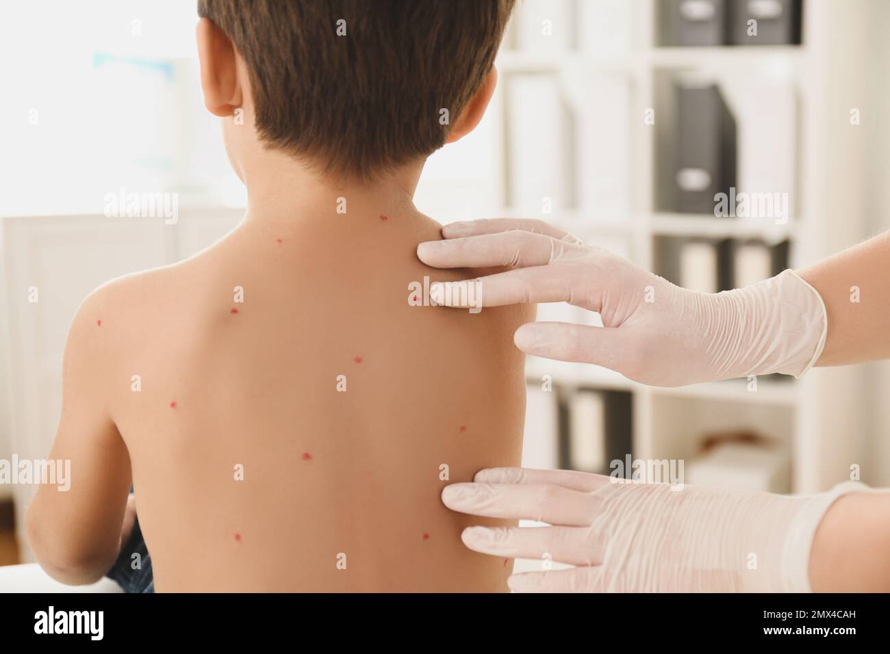 Doctor examining little boy with chickenpox in clinic, closeup ...