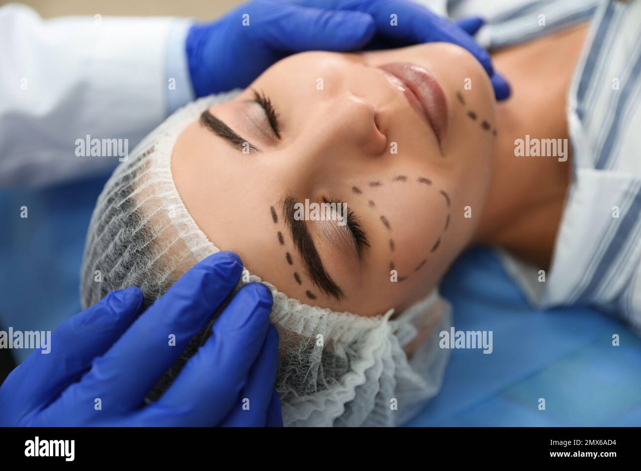 Doctor preparing female patient for cosmetic surgery in clinic Stock ...