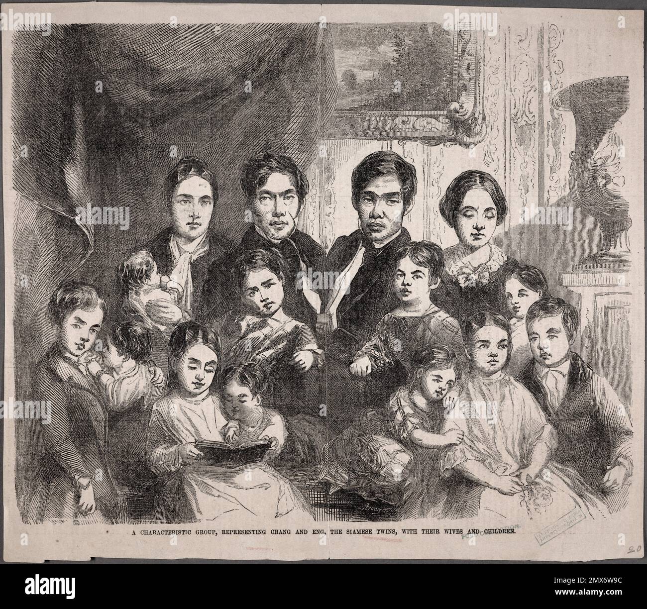 Siamese conjoined twin hi-res stock photography and images - Alamy