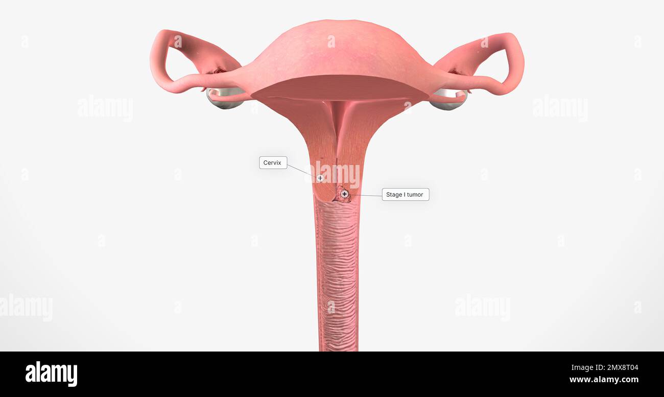 Scleroderma anatomy hi-res stock photography and images - Alamy