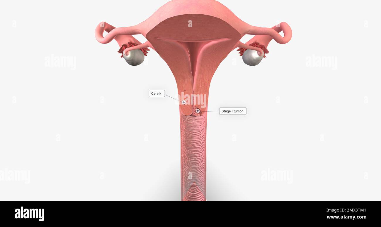 Scleroderma anatomy hi-res stock photography and images - Alamy