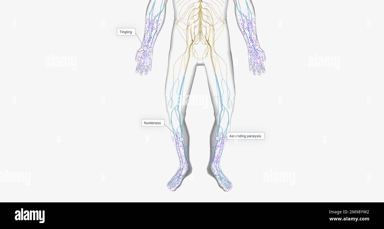 Attacks your nerves hi-res stock photography and images - Alamy