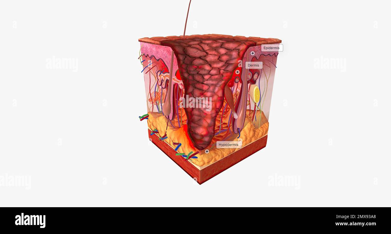 Burn skin scar Cut Out Stock Images & Pictures - Alamy