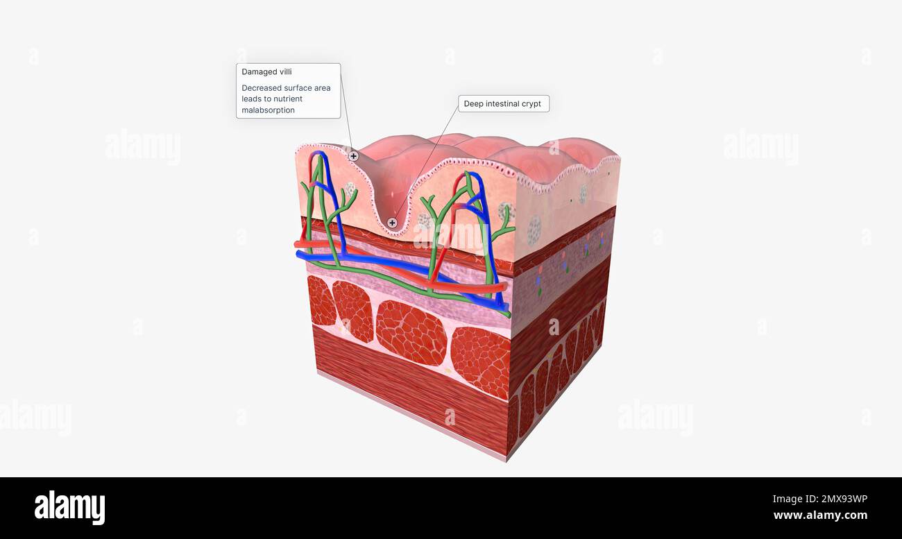 Histology of the intestine large Cut Out Stock Images & Pictures - Alamy