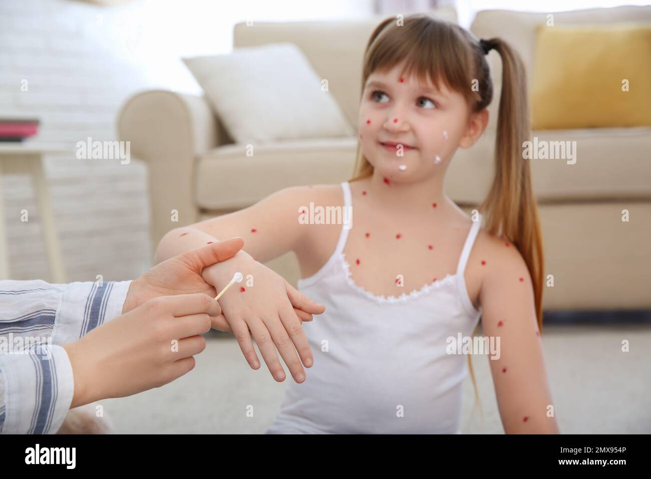 Woman skin rash happy hi-res stock photography and images - Alamy
