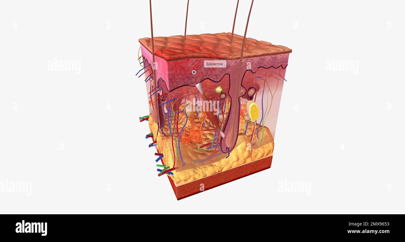 Burn wound woman arm hi-res stock photography and images - Alamy