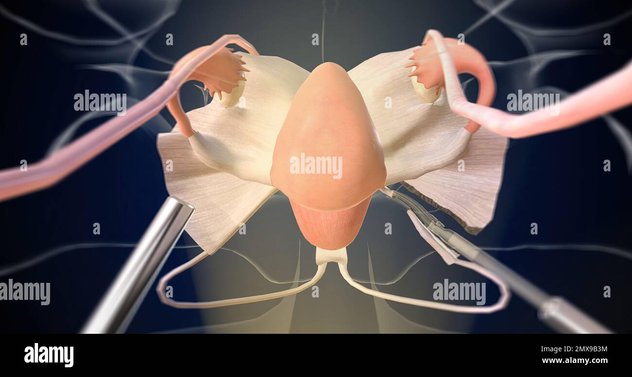 Mrgfus hi-res stock photography and images - Alamy