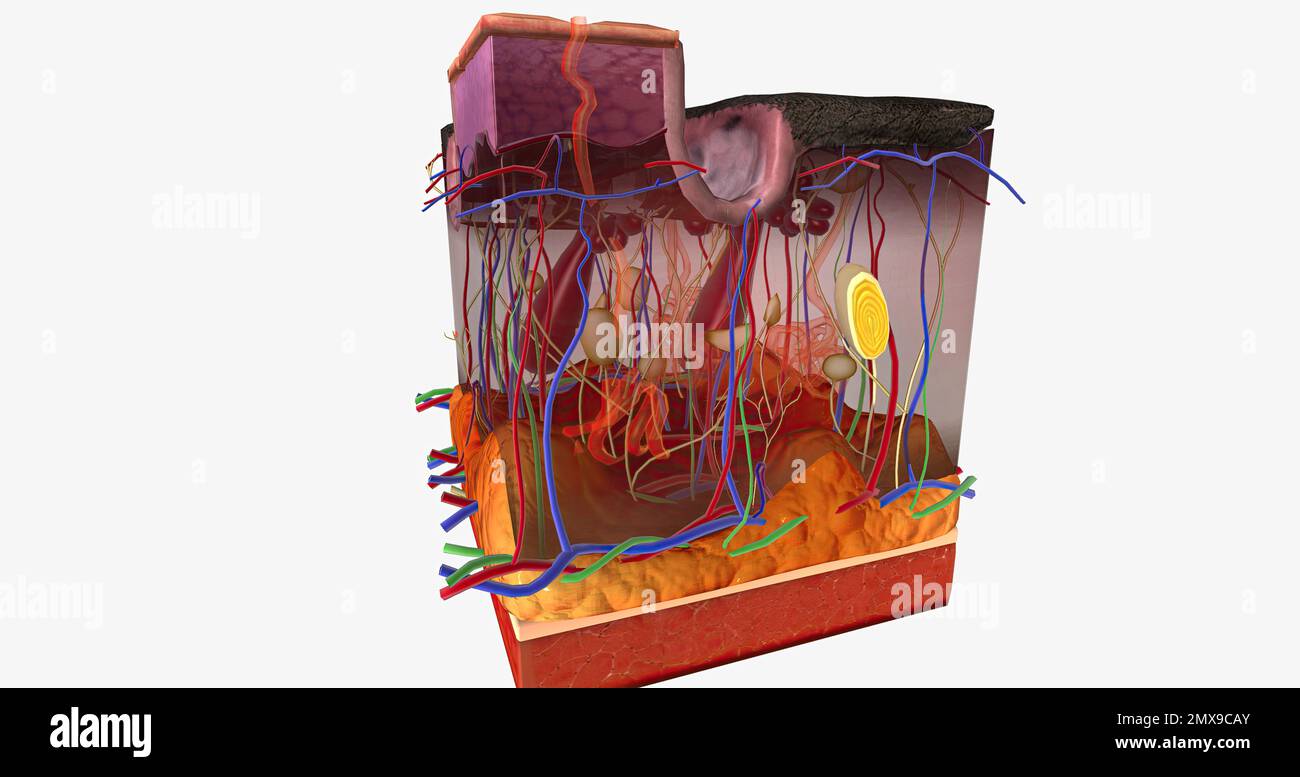 The Calciphylaxis in the Skin 3D rendering Stock Photo - Alamy