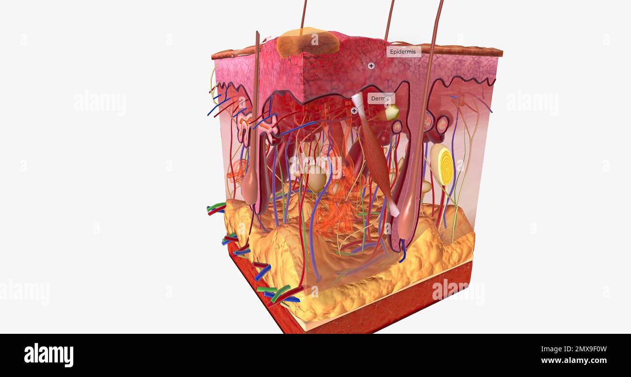 Thermal trauma hi-res stock photography and images - Alamy