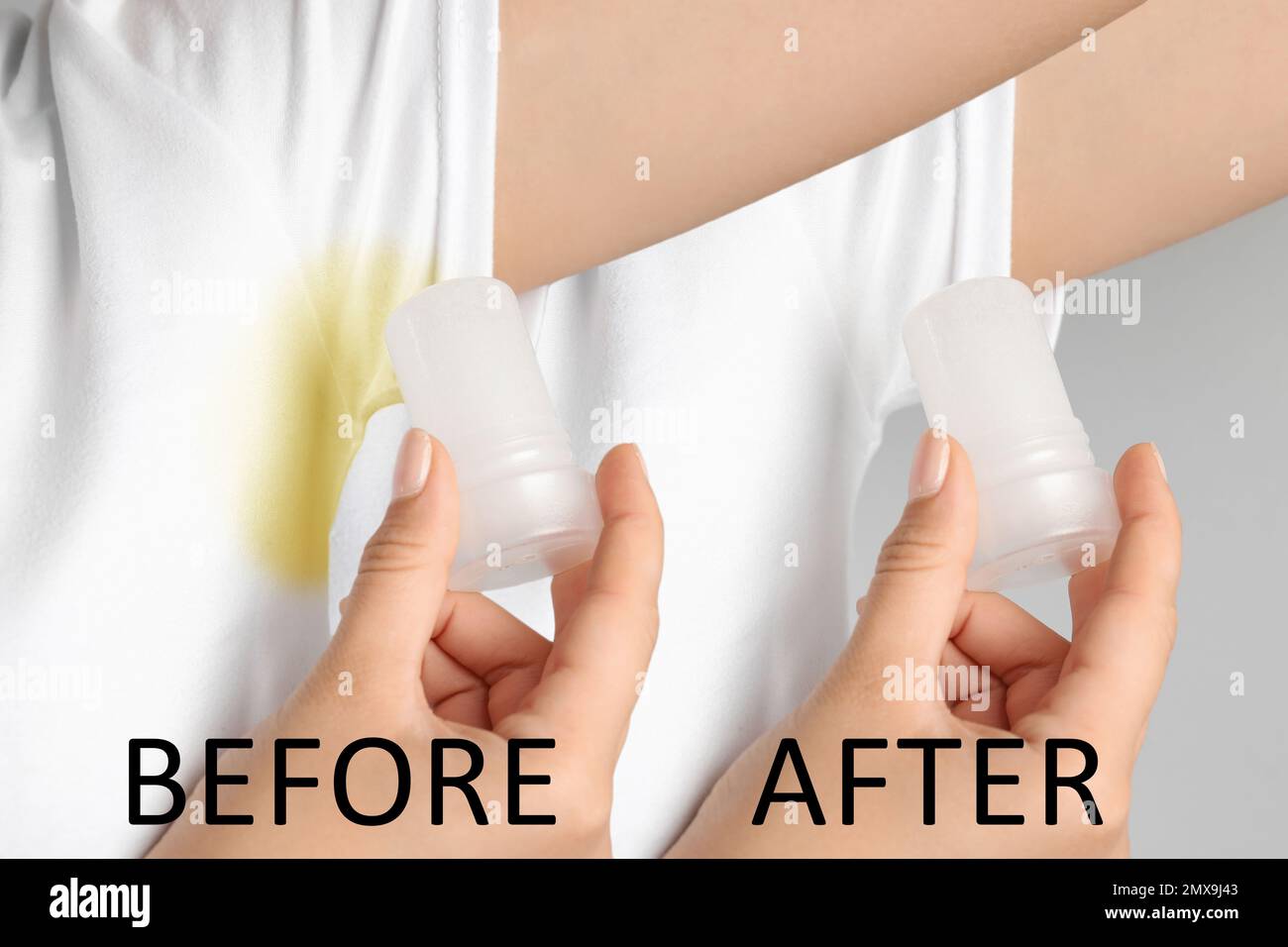Woman before and after using deodorant on light background, closeup ...
