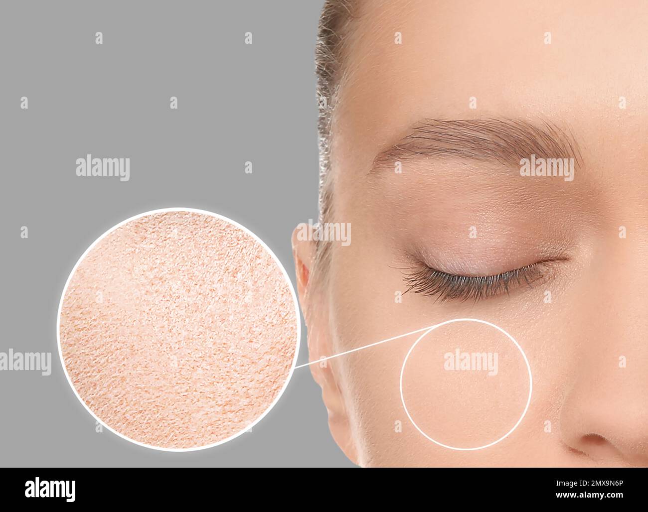 Desquamation of the skin hi-res stock photography and images - Alamy