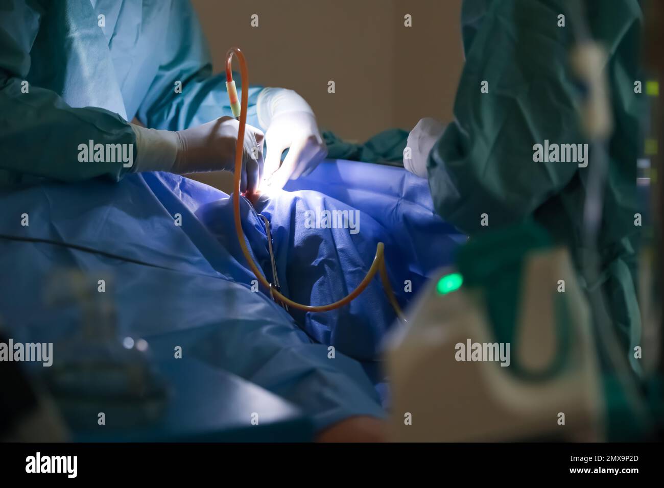 Professional doctors performing operation in surgery room, closeup ...
