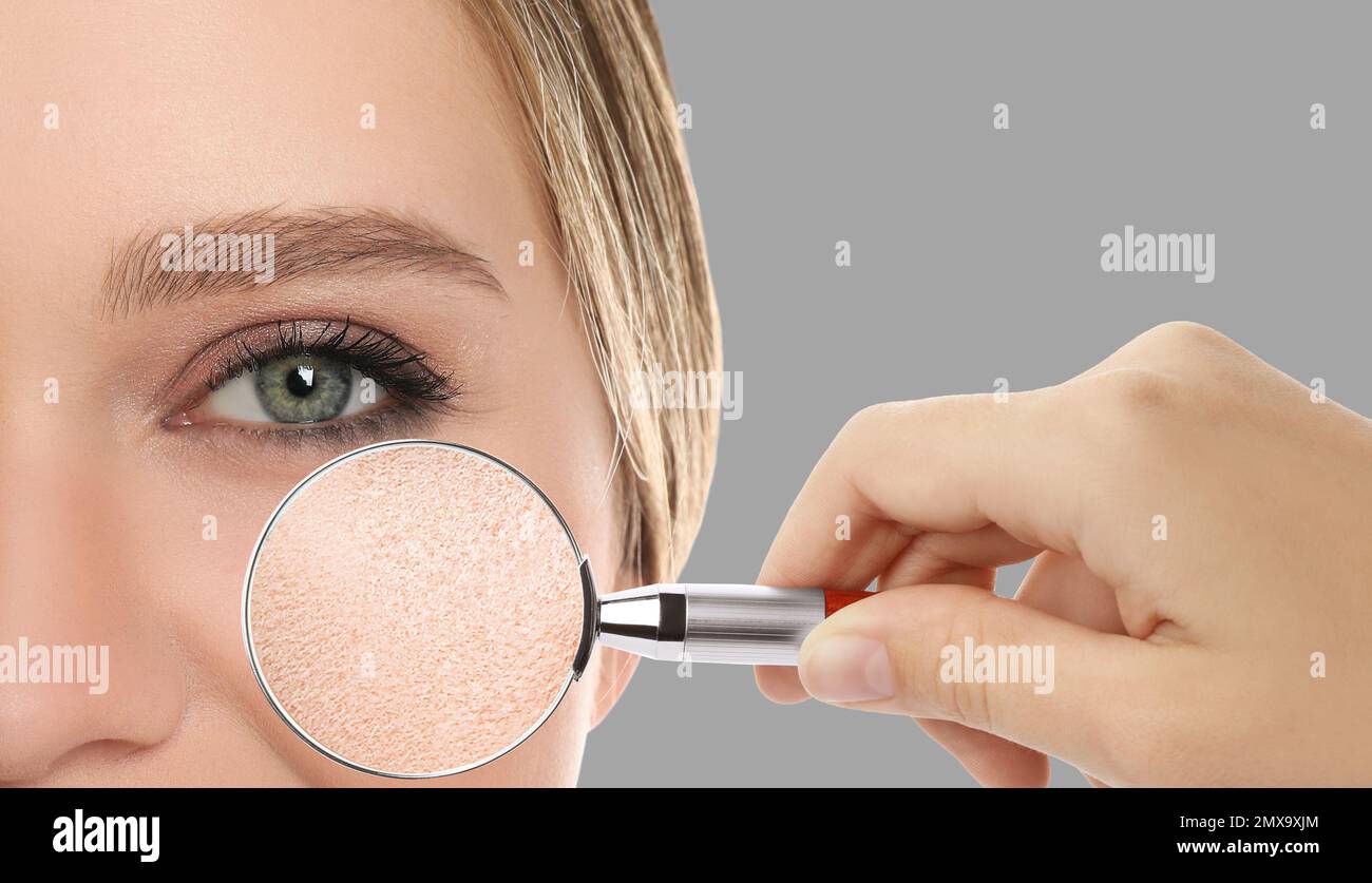 Desquamation of the skin hi-res stock photography and images - Alamy