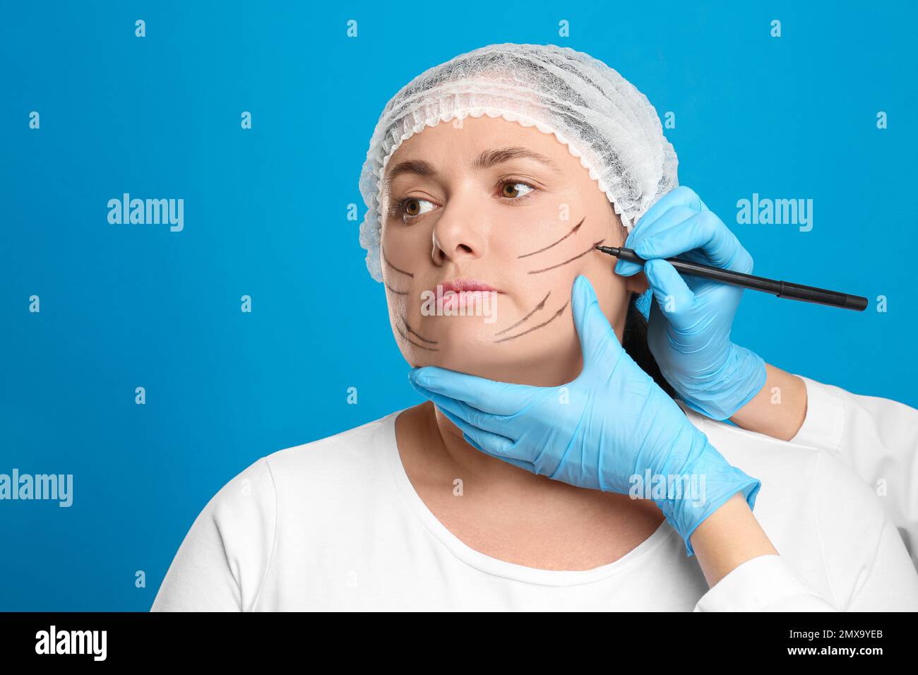 Doctor drawing marks on woman's face for cosmetic surgery operation ...