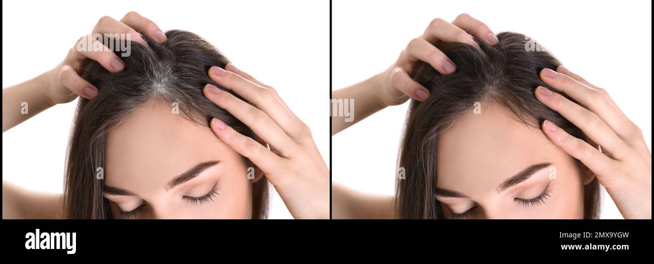 Collage of woman with grey hair before and after coloring on white ...