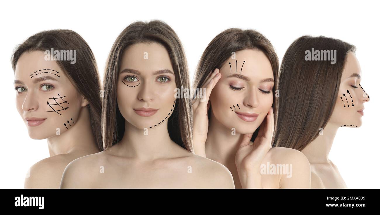 Photos of young woman with lifting marks on face against white ...