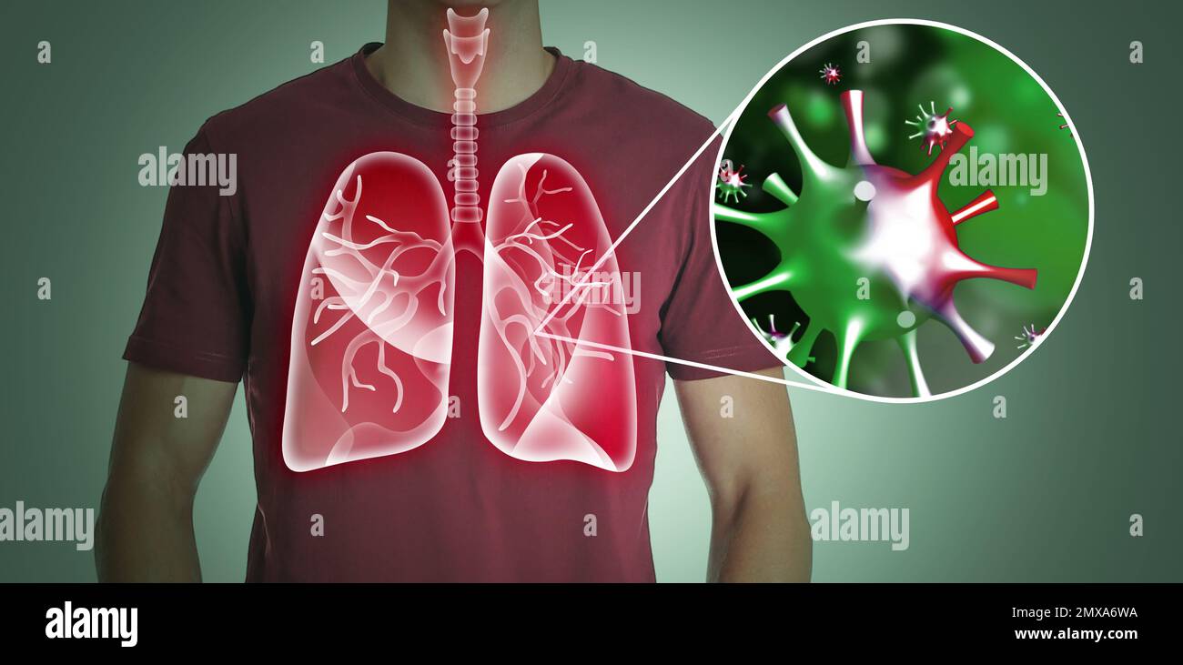 Lung breathing hard hi-res stock photography and images - Alamy