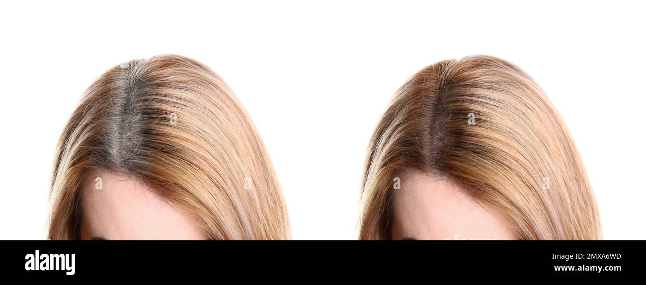 Collage of woman with grey hair before and after coloring on white ...