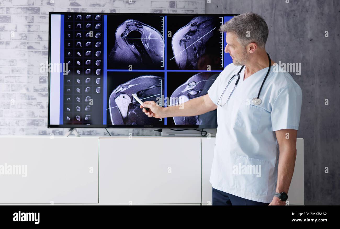 Physician Doctors Looking At Shoulder MRT Scan Stock Photo - Alamy