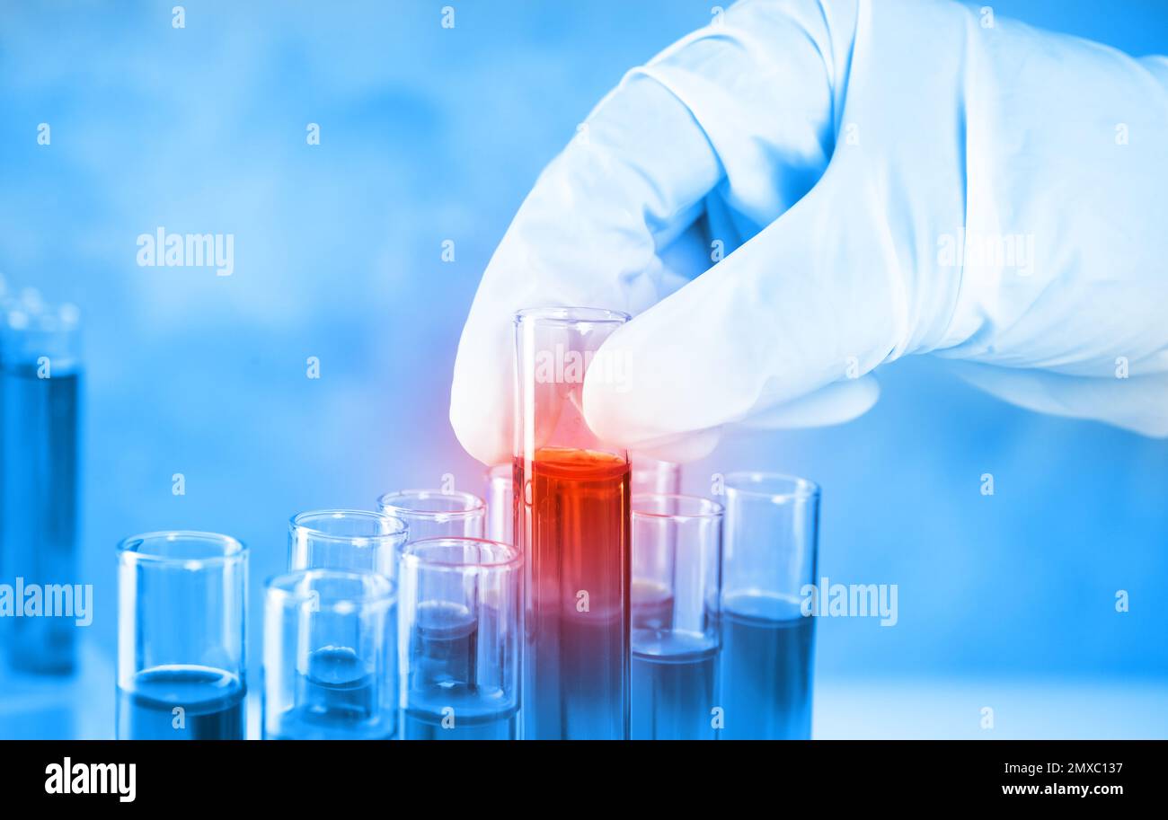 Scientist taking test tube with liquid sample, closeup. Laboratory ...