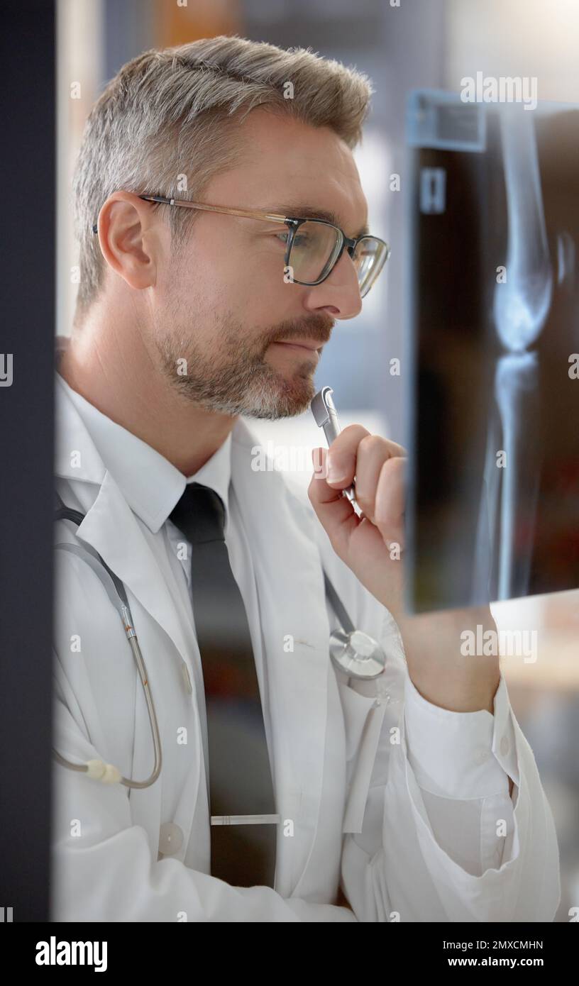 Analysis, healthcare and doctor looking at an x ray for research, body ...