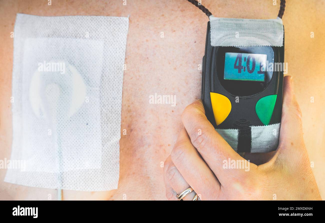 Holter ecg monitoring hi-res stock photography and images - Alamy