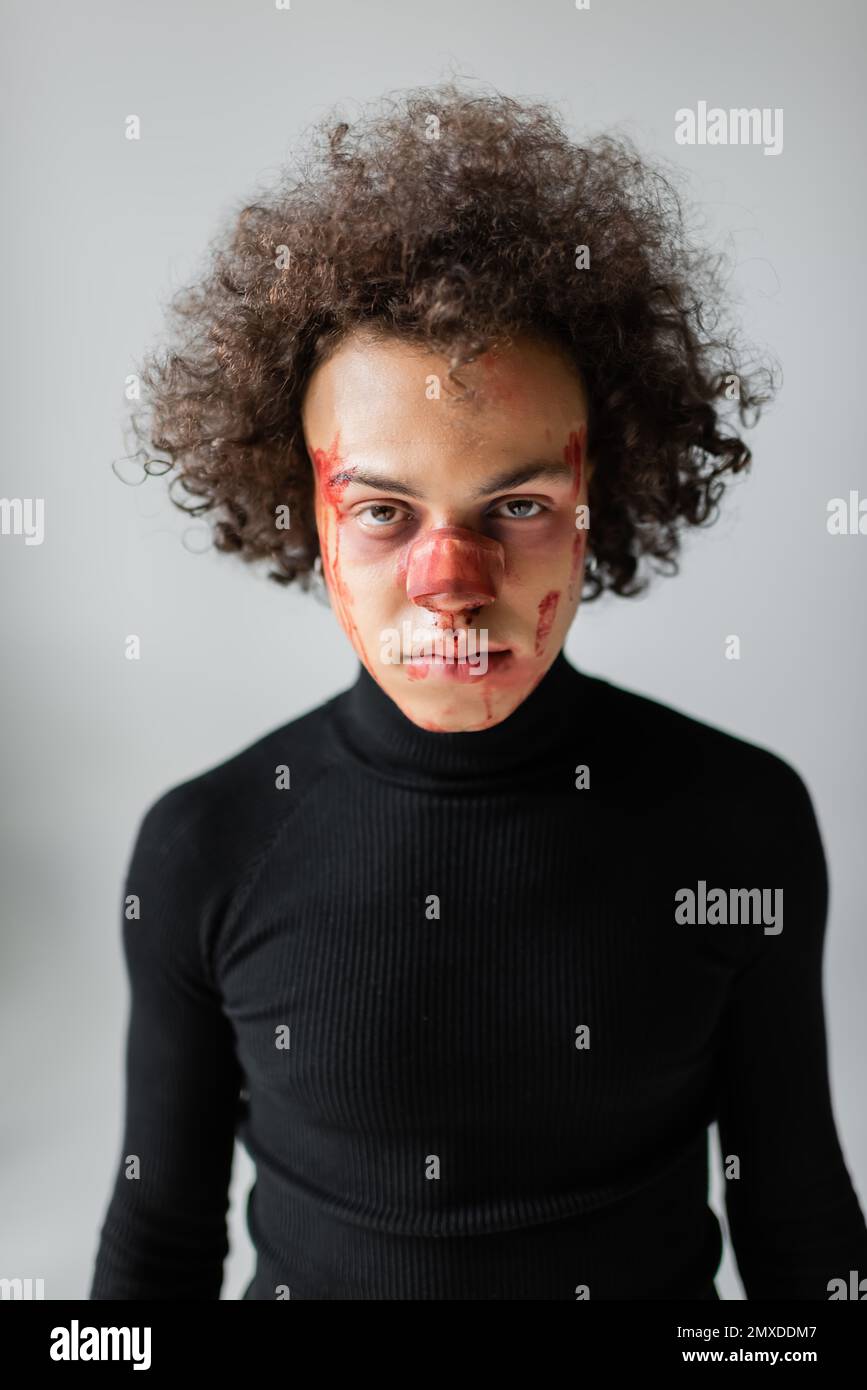 Broken nose hi-res stock photography and images - Alamy