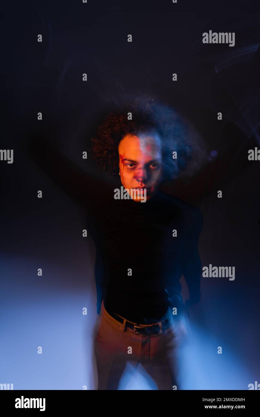 injured african american man with bipolar disorder and bleeding face ...