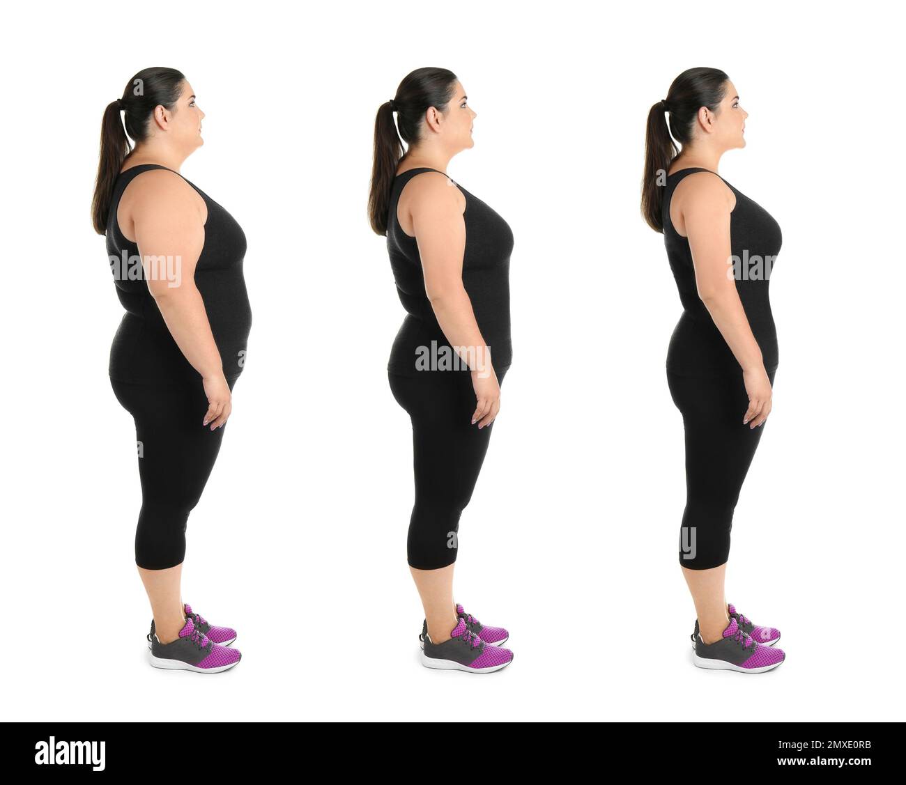 Collage With Photos Of Overweight Woman Before And After Weight Loss On