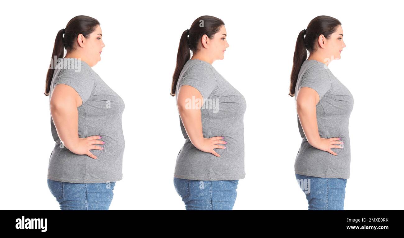 Collage with photos of overweight woman before and after weight loss on ...