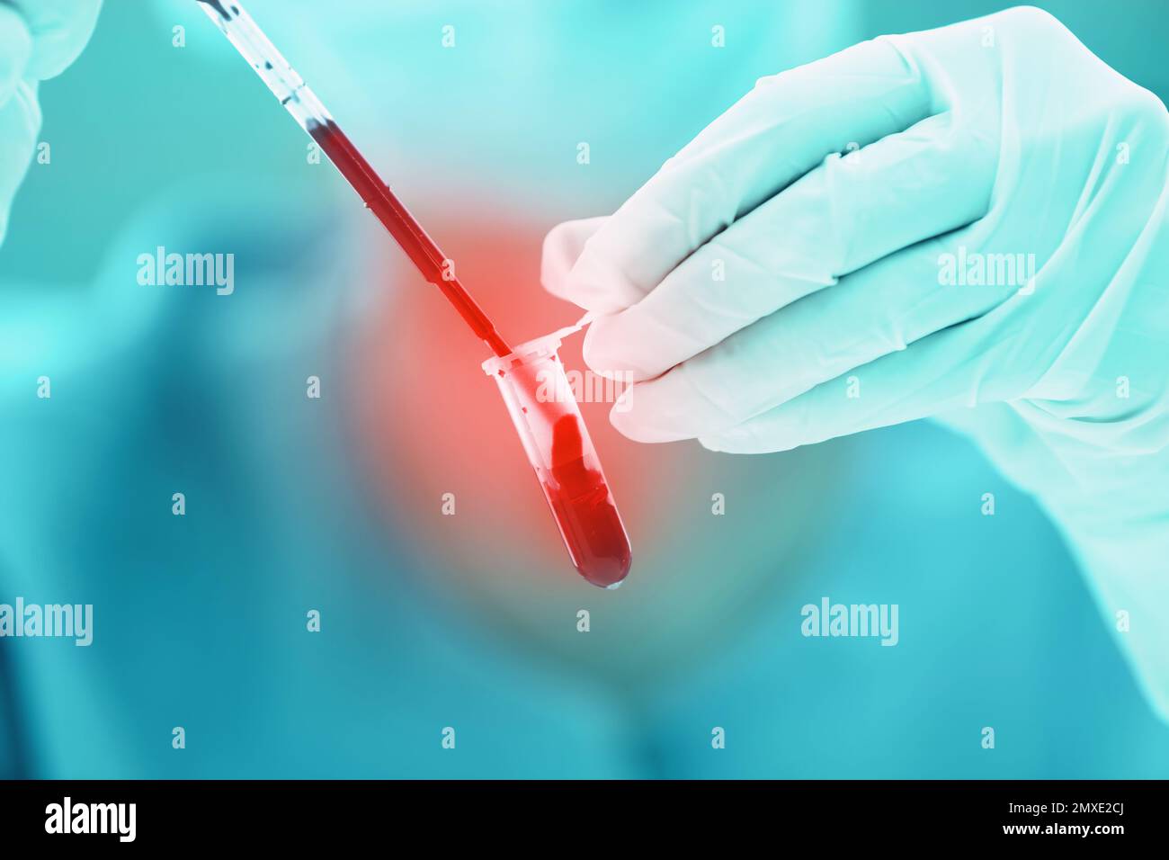 Scientist dripping blood into test tube, closeup. Laboratory analysis ...
