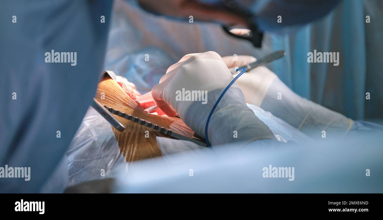 Closeup of professional doctor hands operating a patient during open ...