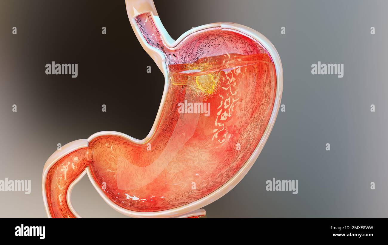 3d Illustration of Human Stomach Anatomy Digestion, 3D reander Stock ...