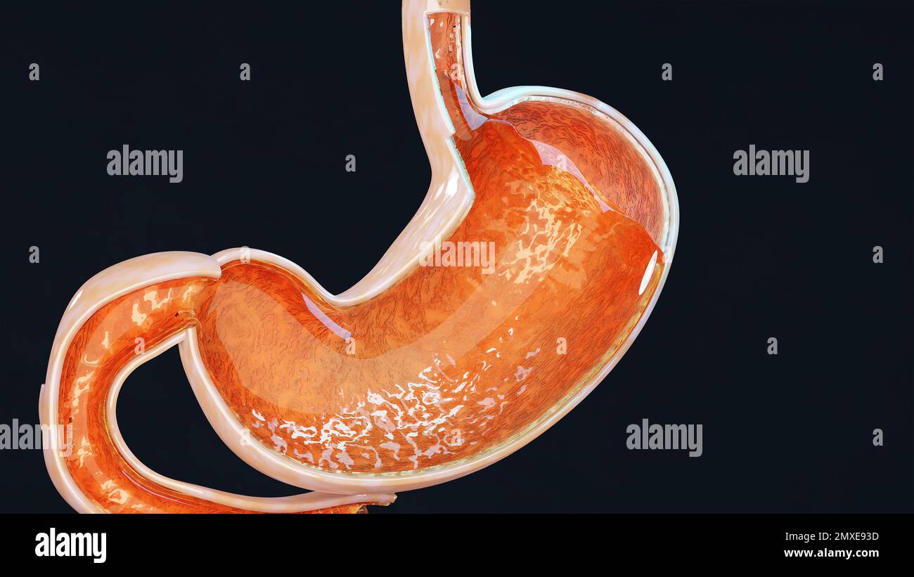 Stomach Acid Relux. Esophagus, gerd. Pain In The Digestive System ...