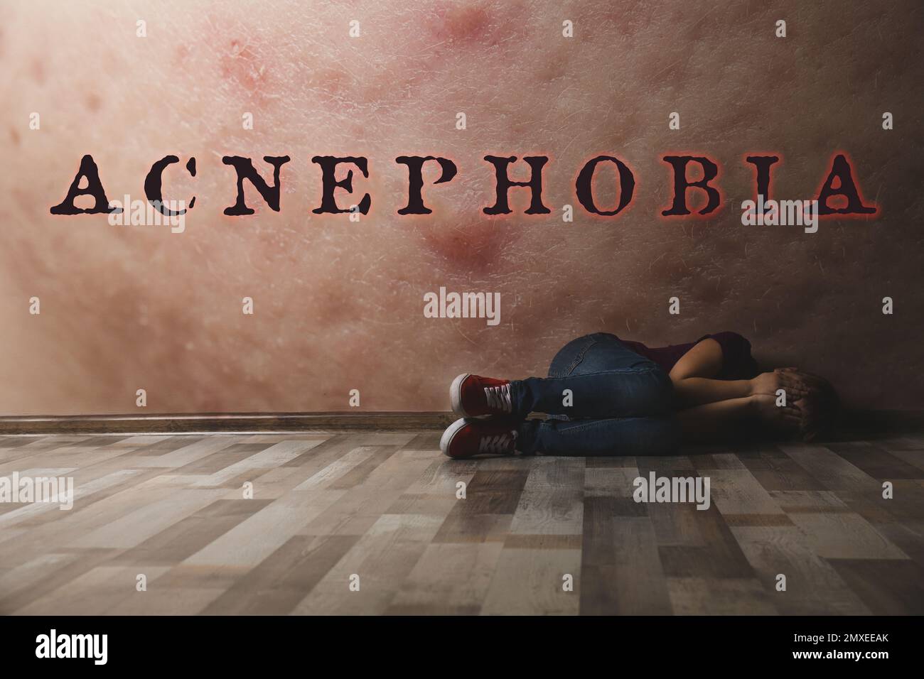 Scared little girl suffering from acnephobia. Vision of problem skin ...