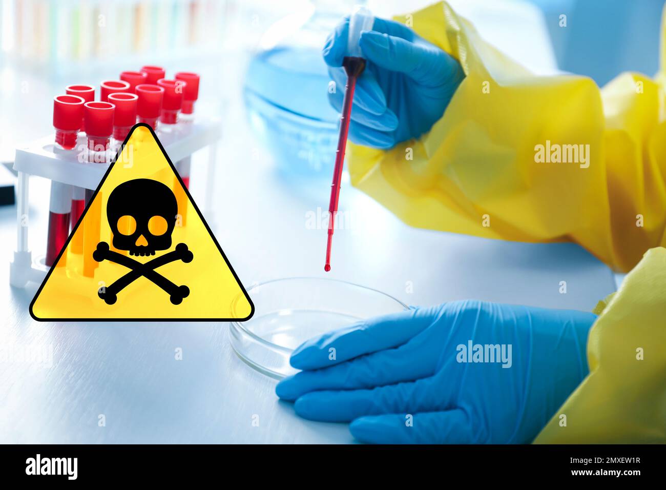 Poison sign and scientist dripping blood sample into Petri dish at ...