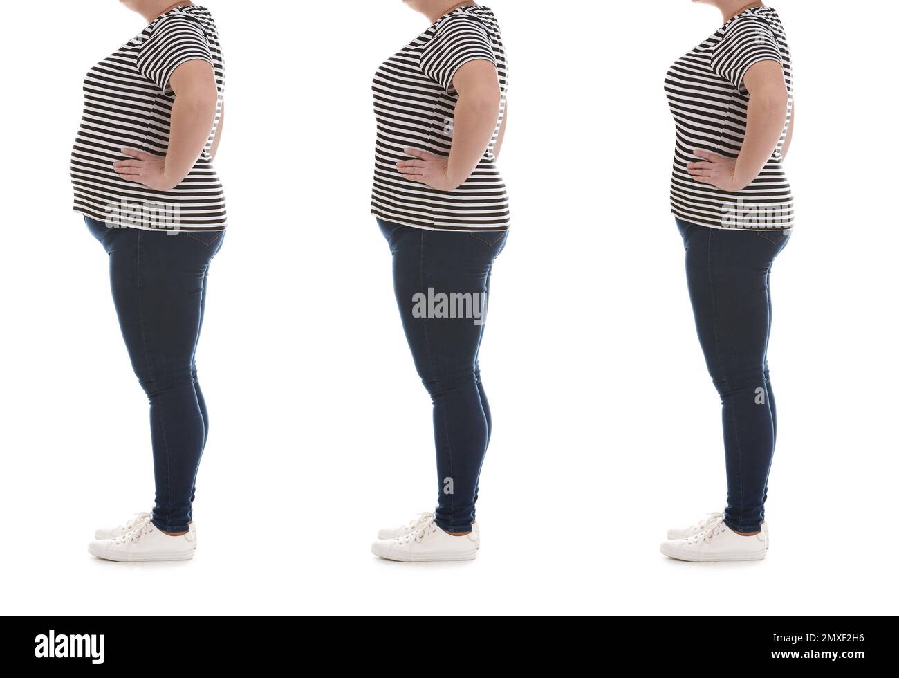 Collage with photos of overweight woman before and after weight loss on ...