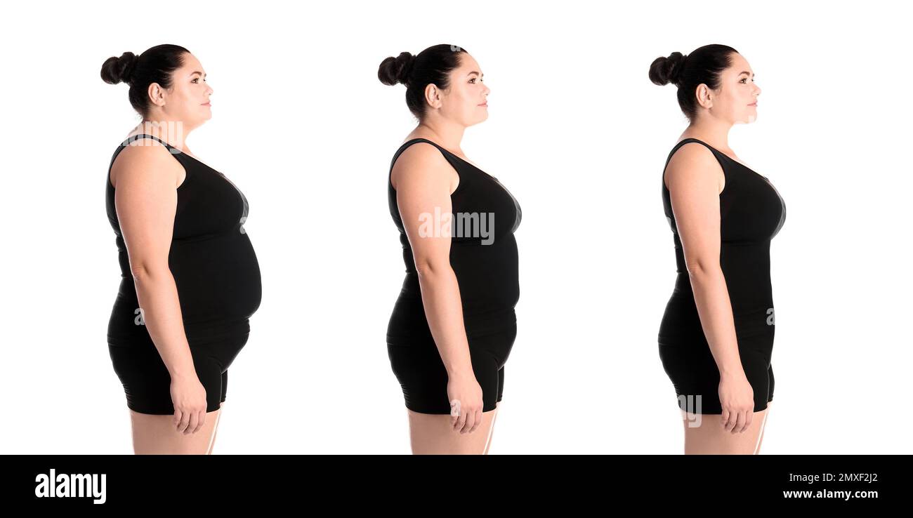 Collage with photos of overweight woman before and after weight loss on ...