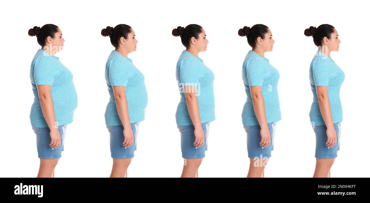 Collage with photos of overweight woman before and after weight loss on ...