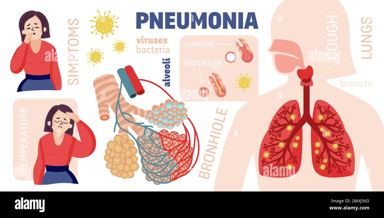 Human pneumonia infographics with cartoon style female characters text ...