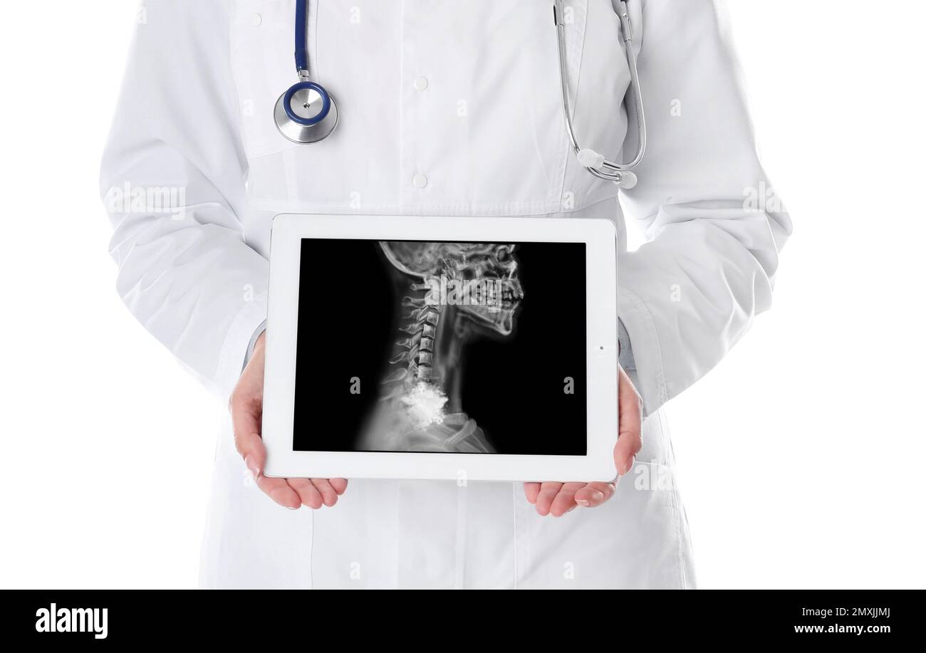 Doctor showing x-ray of patient with cancer on tablet against white ...