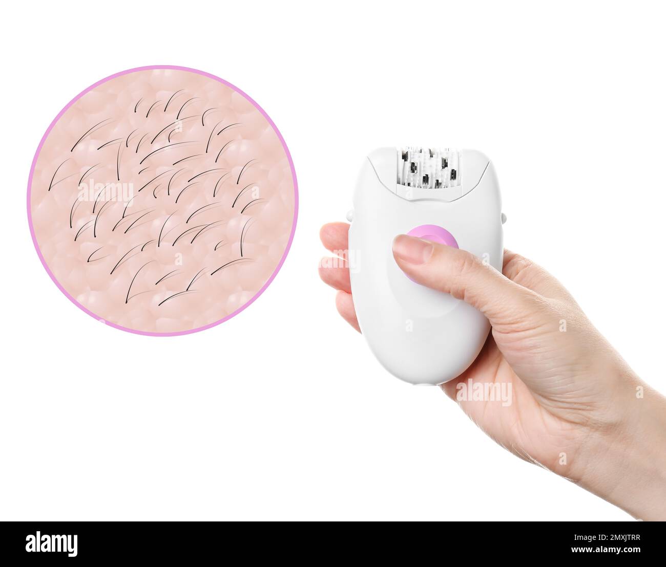 Epilation procedure. Woman holding modern appliance near illustration ...
