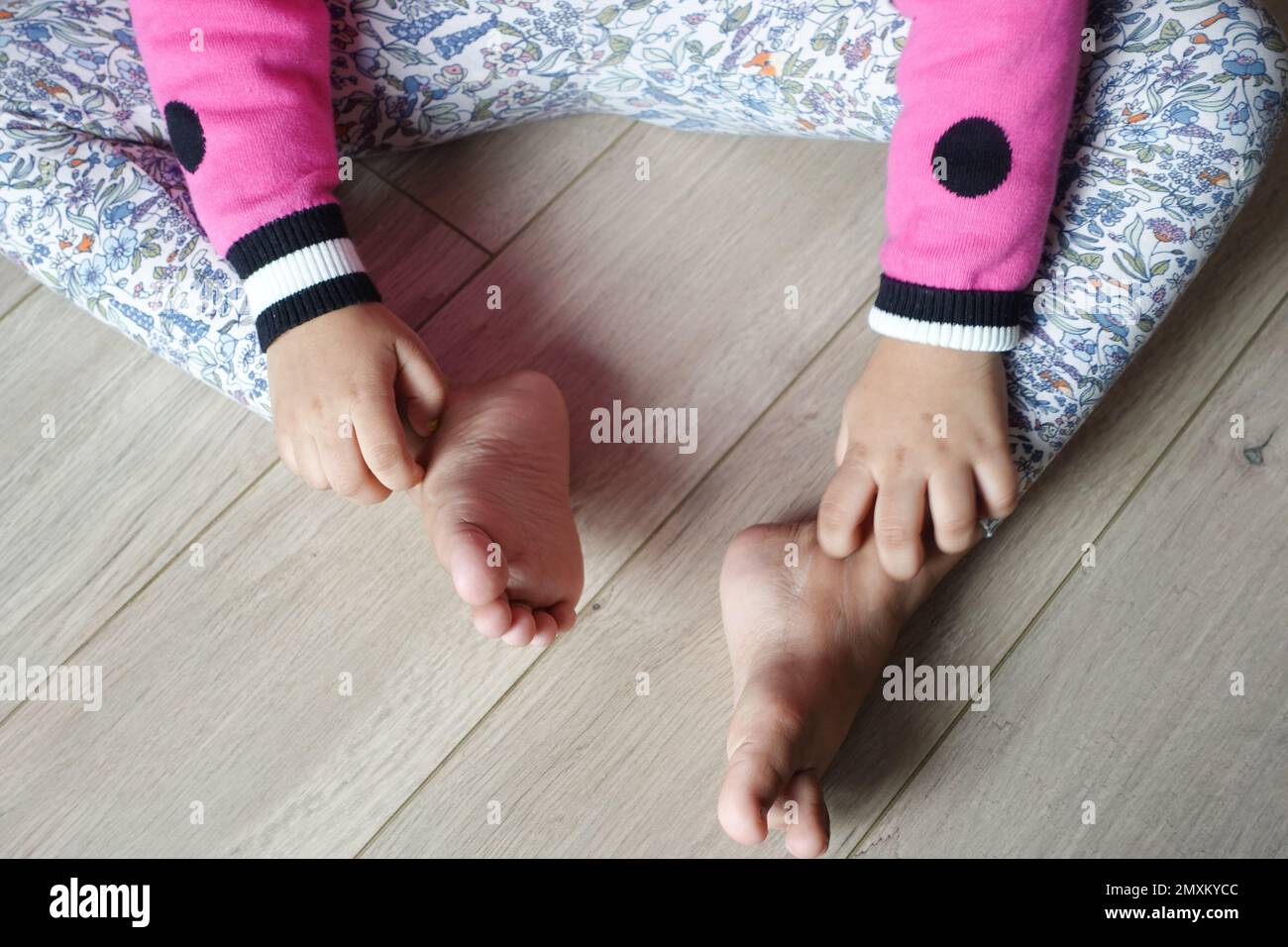 child girl suffering from itching skin, close up Stock Photo - Alamy
