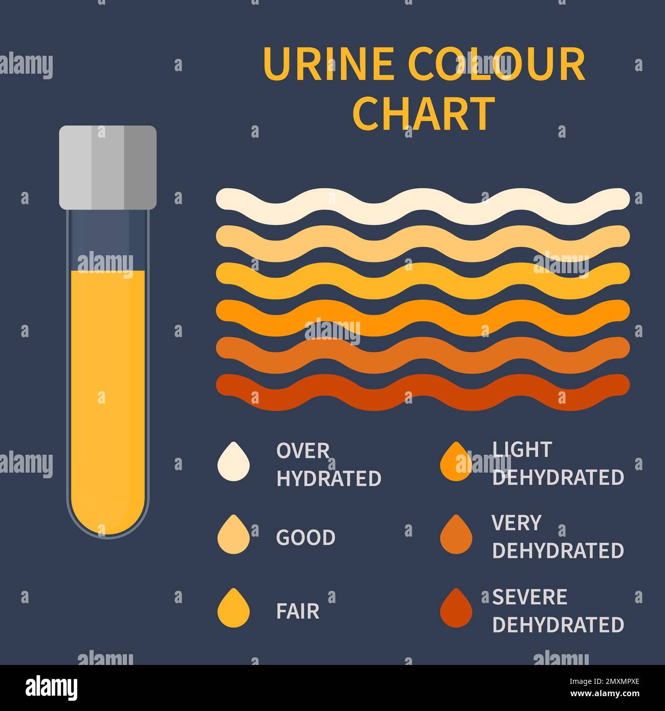 Urine colour chart, illustration Stock Photo - Alamy