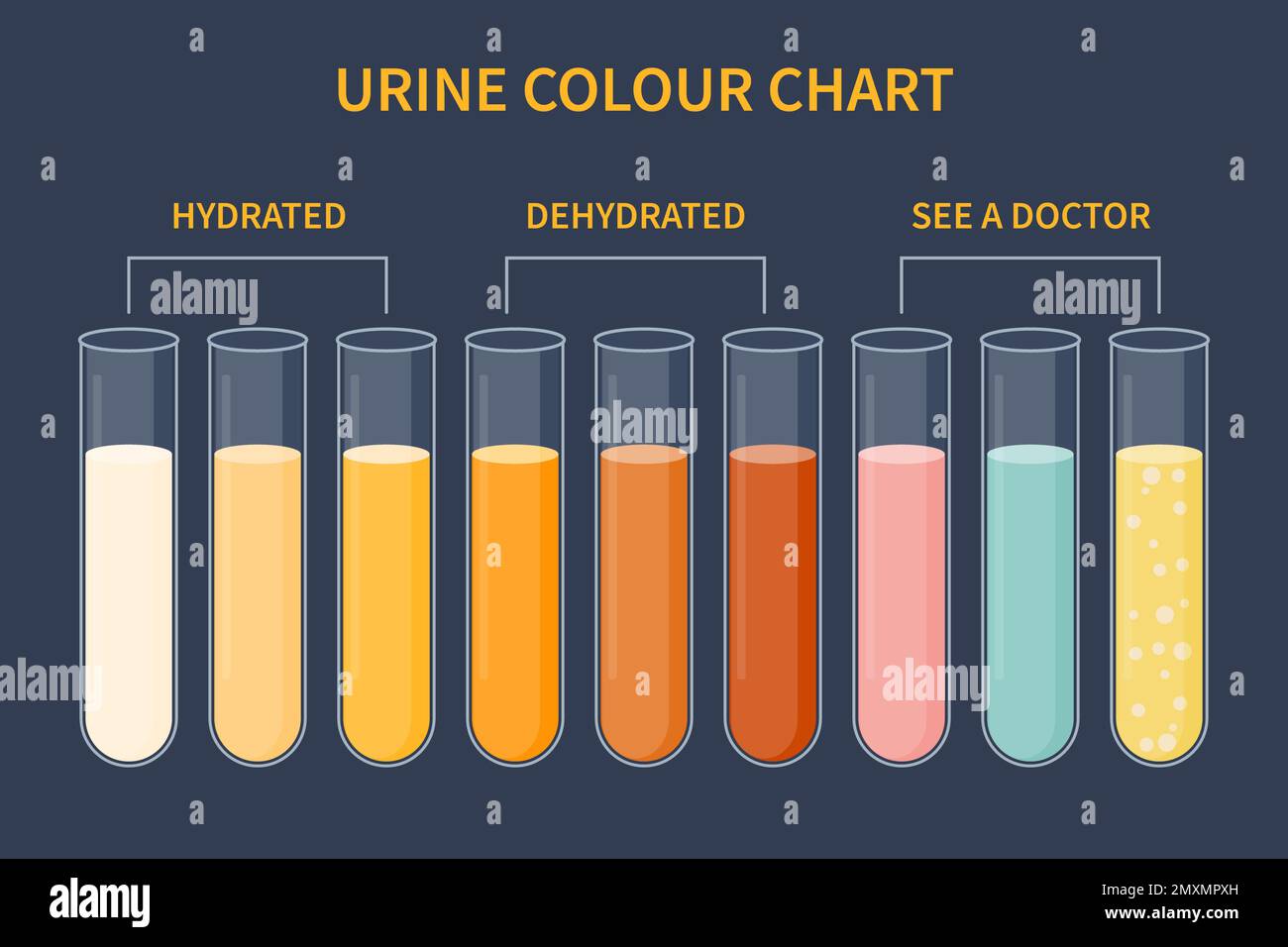 Urine colour chart, illustration Stock Photo - Alamy