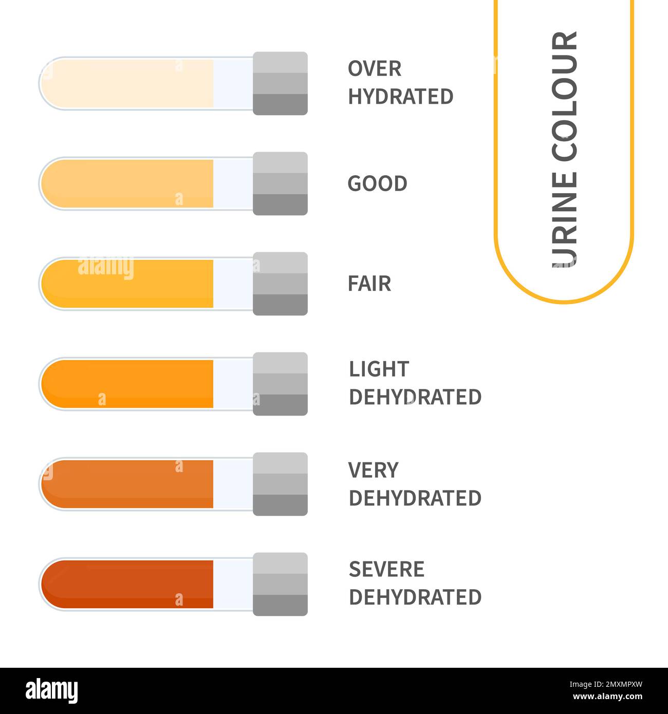 Urine colour chart, illustration Stock Photo - Alamy