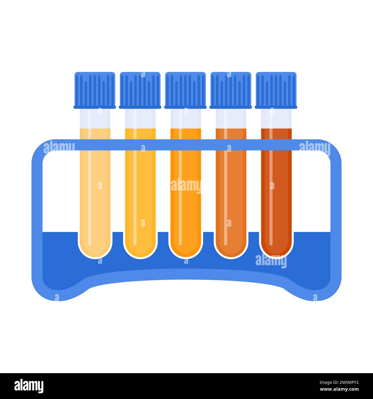 Urine colour chart, illustration Stock Photo - Alamy