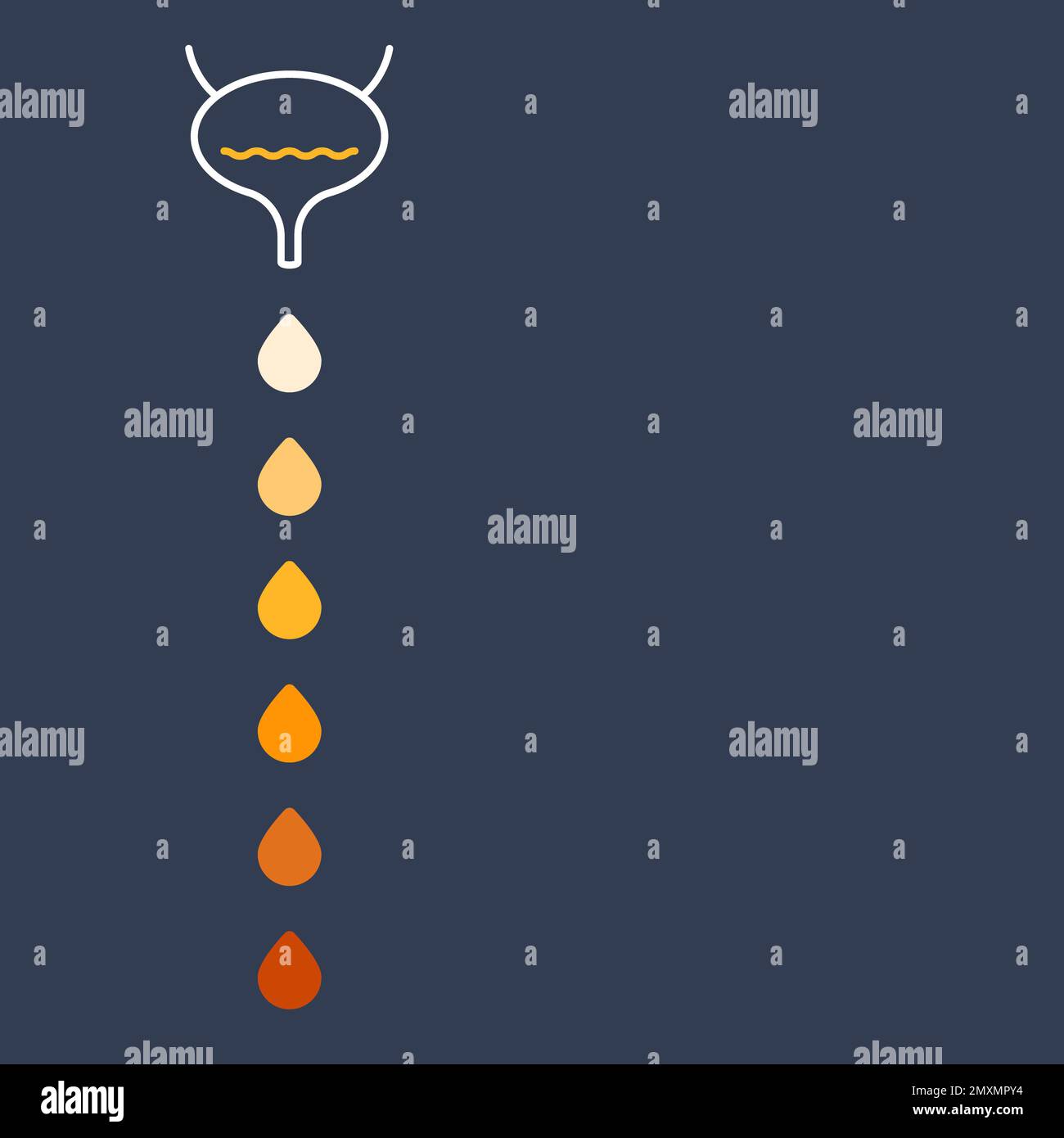 Urine colour chart, illustration Stock Photo - Alamy