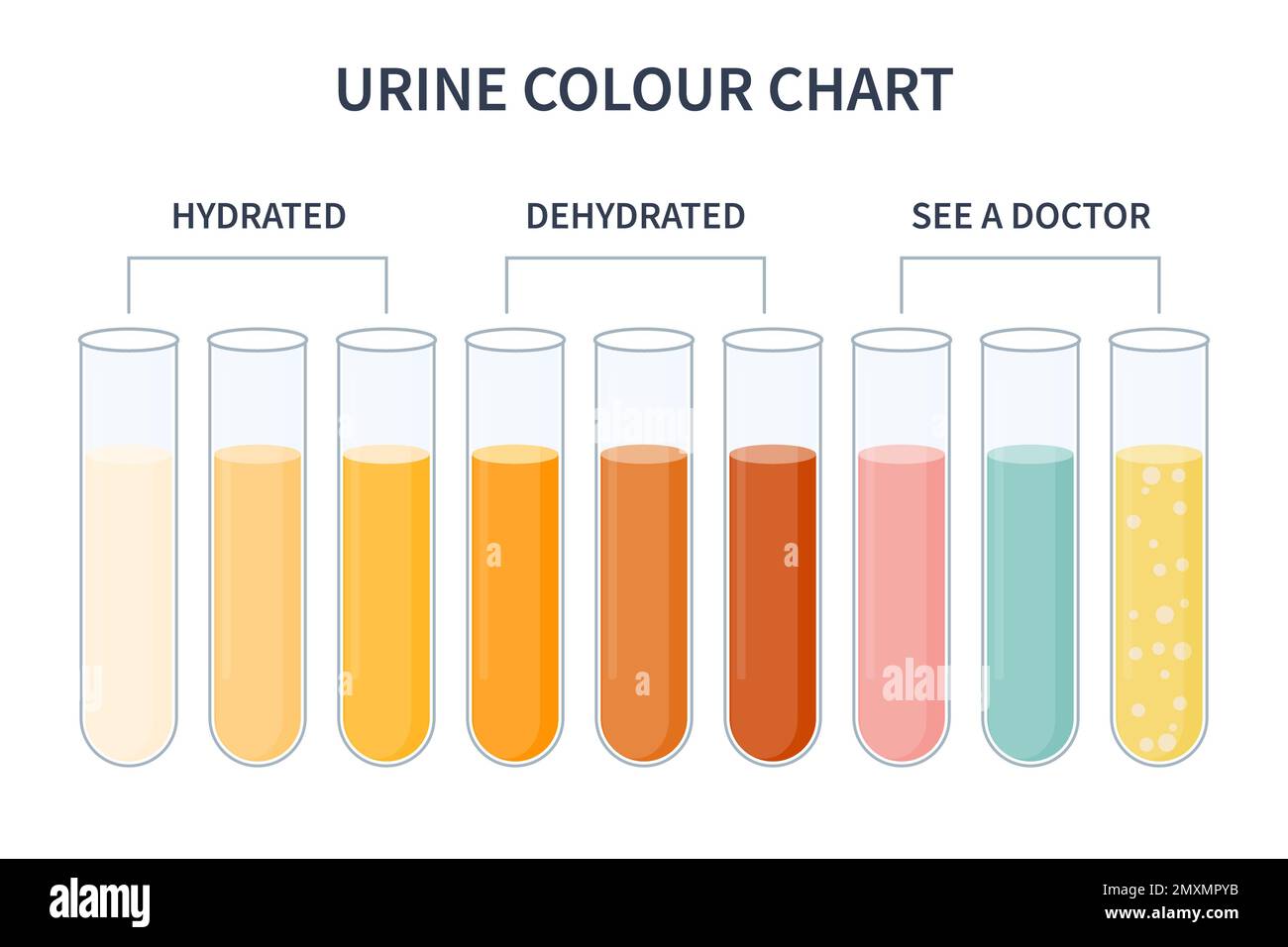 Urine colour chart, illustration Stock Photo - Alamy