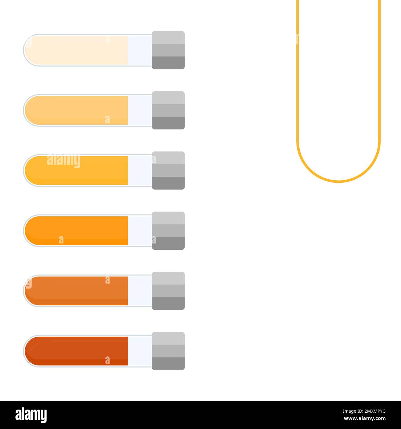 Urine colour chart, illustration Stock Photo - Alamy